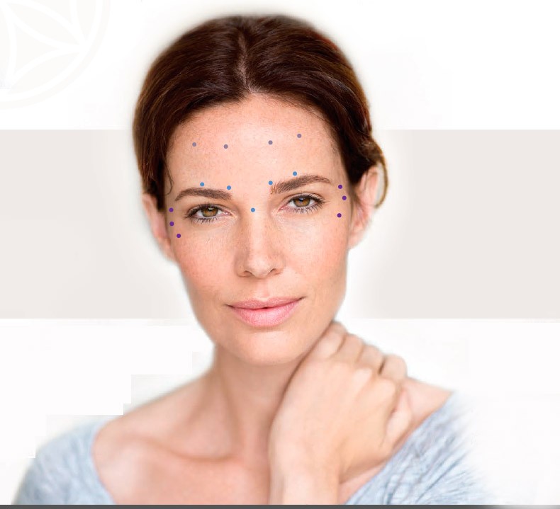 Botulinum Toxin Injection with Botox® / Vistabel®, ALLERGAN (USA) - Art ...